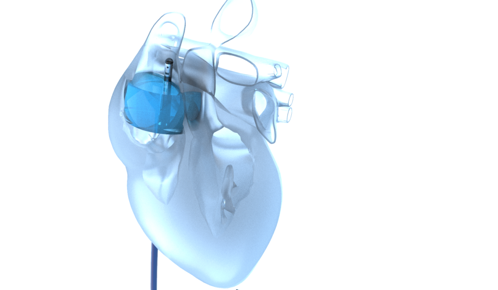 Innovations - LUMA VISION