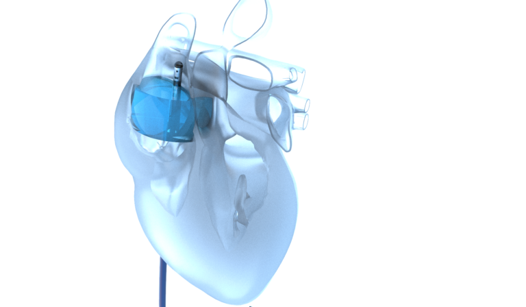 Innovations - LUMA VISION