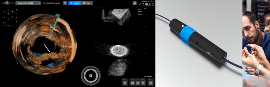 LUMA Vision Secures $17M Funding to Advance 4D Cardiac Imaging - LUMA ...